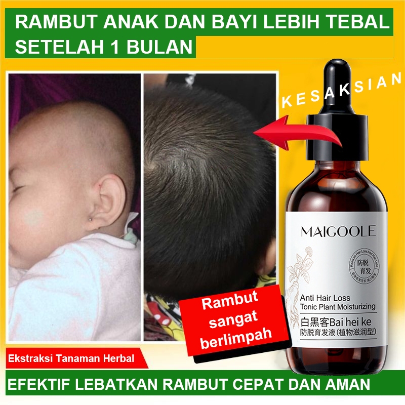 Jual serum penumbuh rambut hair tonic penumbuh rambut bayi dan anak ...