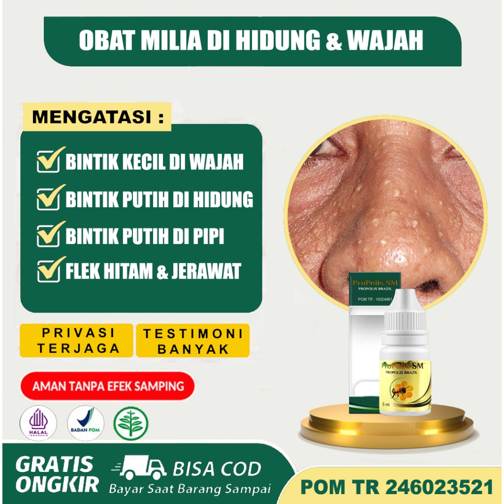 Jual Obat Milia Di Hidung, Sekitar Hidung, Penghilang Milia Di Hidung ...