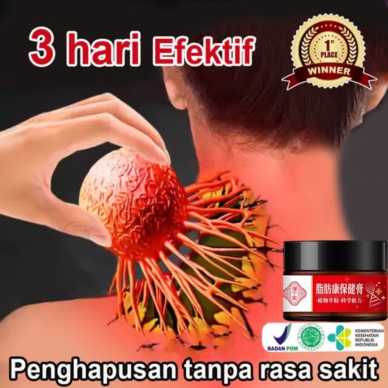 Jual (100% Original)Lipoma Cream salep lipoma salep benjolan Obat ... Jual (100% Original)Lipoma Cream salep lipoma salep benjolan Obat ...