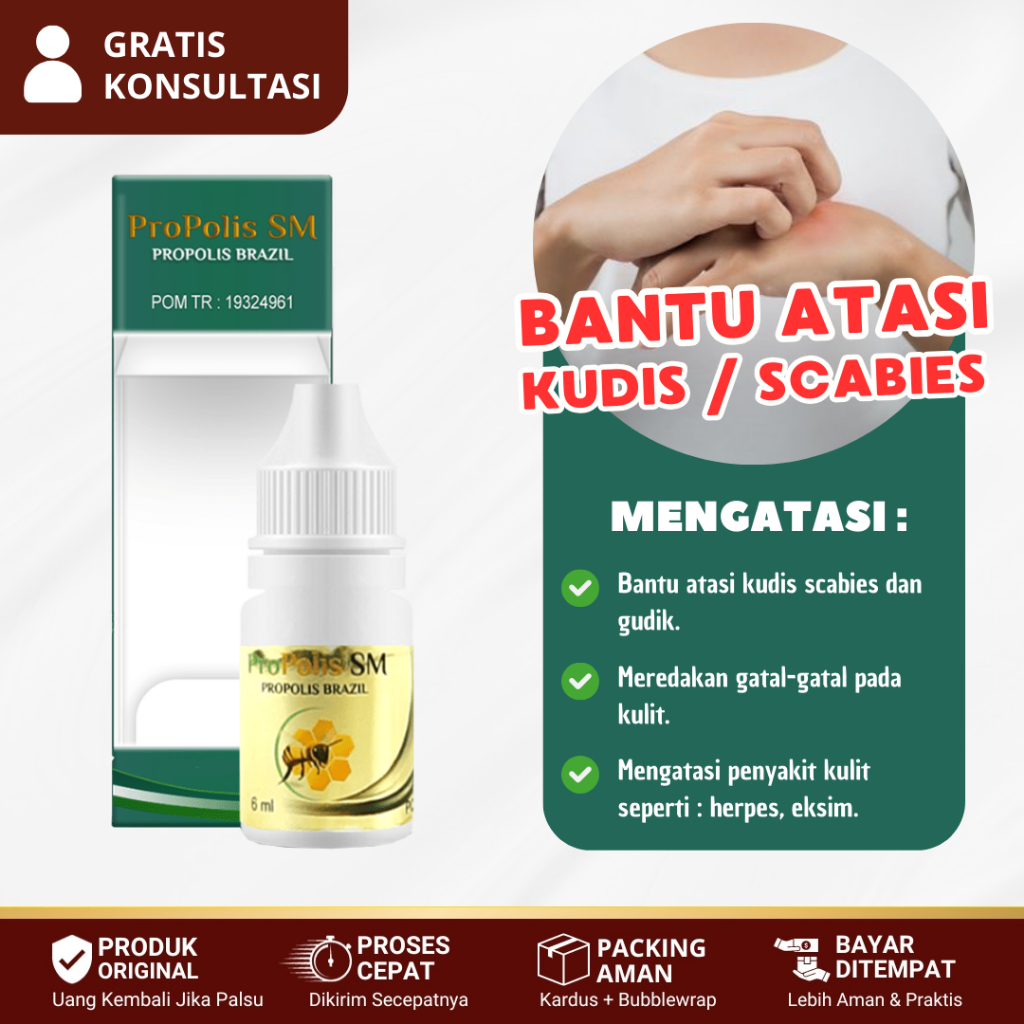 Jual Obat Kudis Anak Dan Dewasa, Gatal Kudis, Scabies Manusia, Obat ...