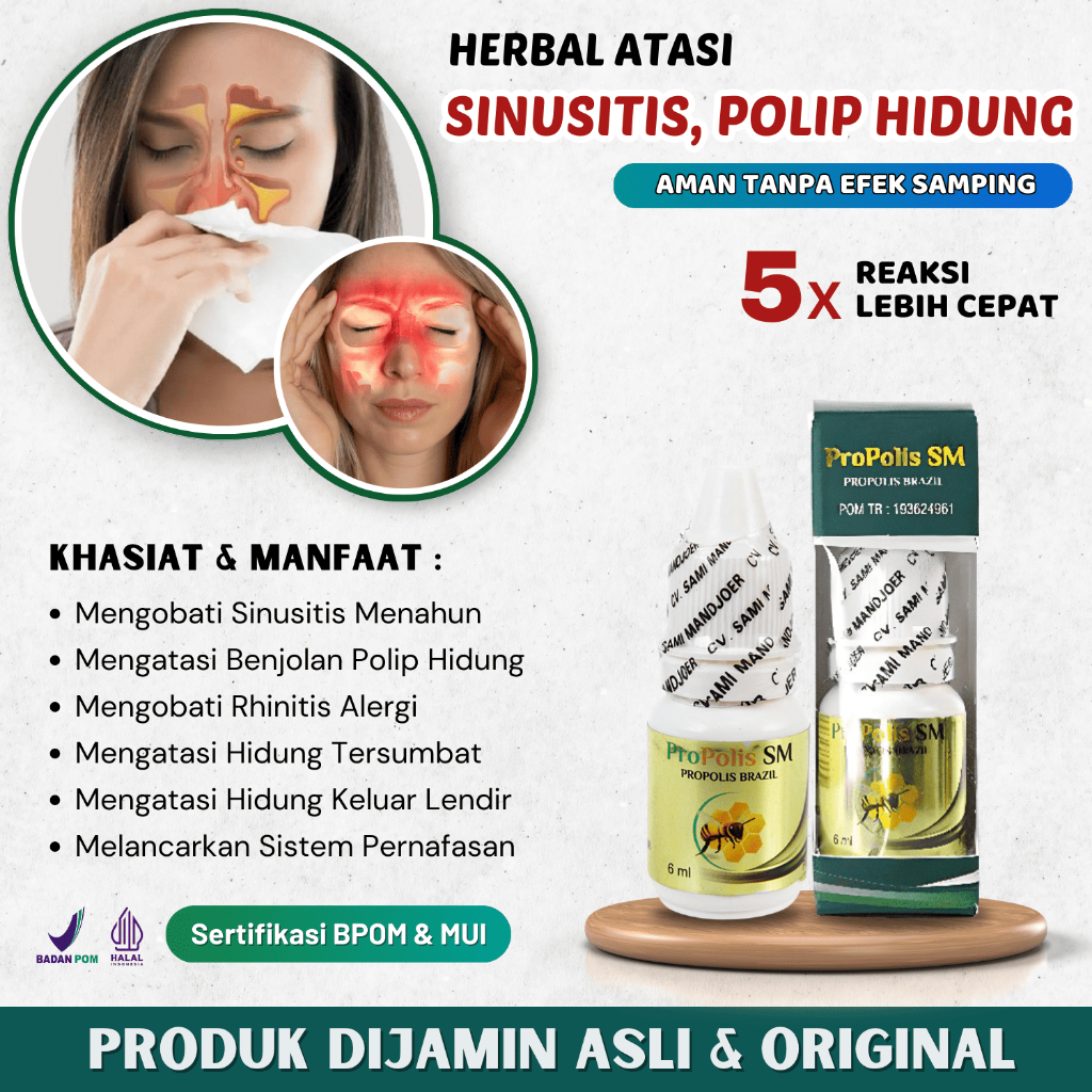 Jual Obat Sinusitis Polip Hidung Rhinitis Alergi Sinus Pilek Hidung ...