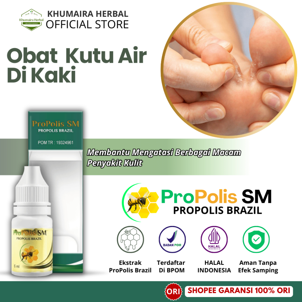 Jual Obat Kutu Air Pada Kaki, Obat Jamur Kaki, Penghilang Kuman Air ...