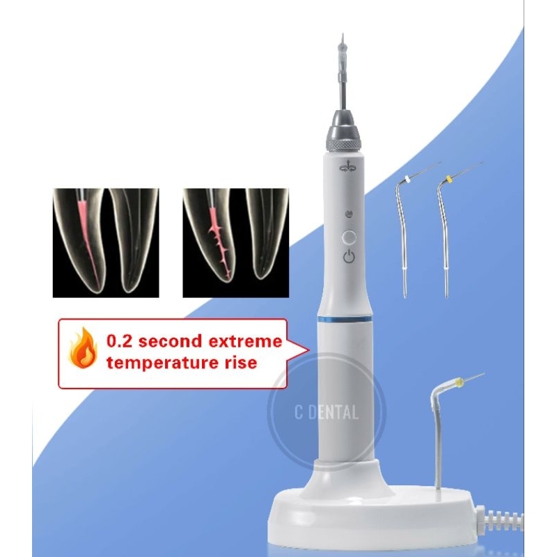 Jual Dental Endo Fast Obturation Plugger Pen Heated Tip Obturasi Gutta ...