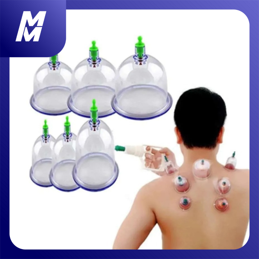 Jual Kop Angin Nikita Murah Alat Bekam 6 Tabung Terapi Alami Masuk Angin | Shopee Indonesia