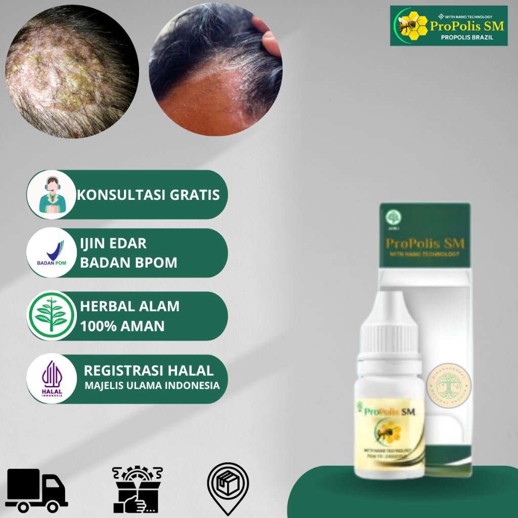 Jual Obat Koreng Di Kepala Kulit Bersisik Kering Luka Borok Koreng Di Kepala Obat Koreng di ...