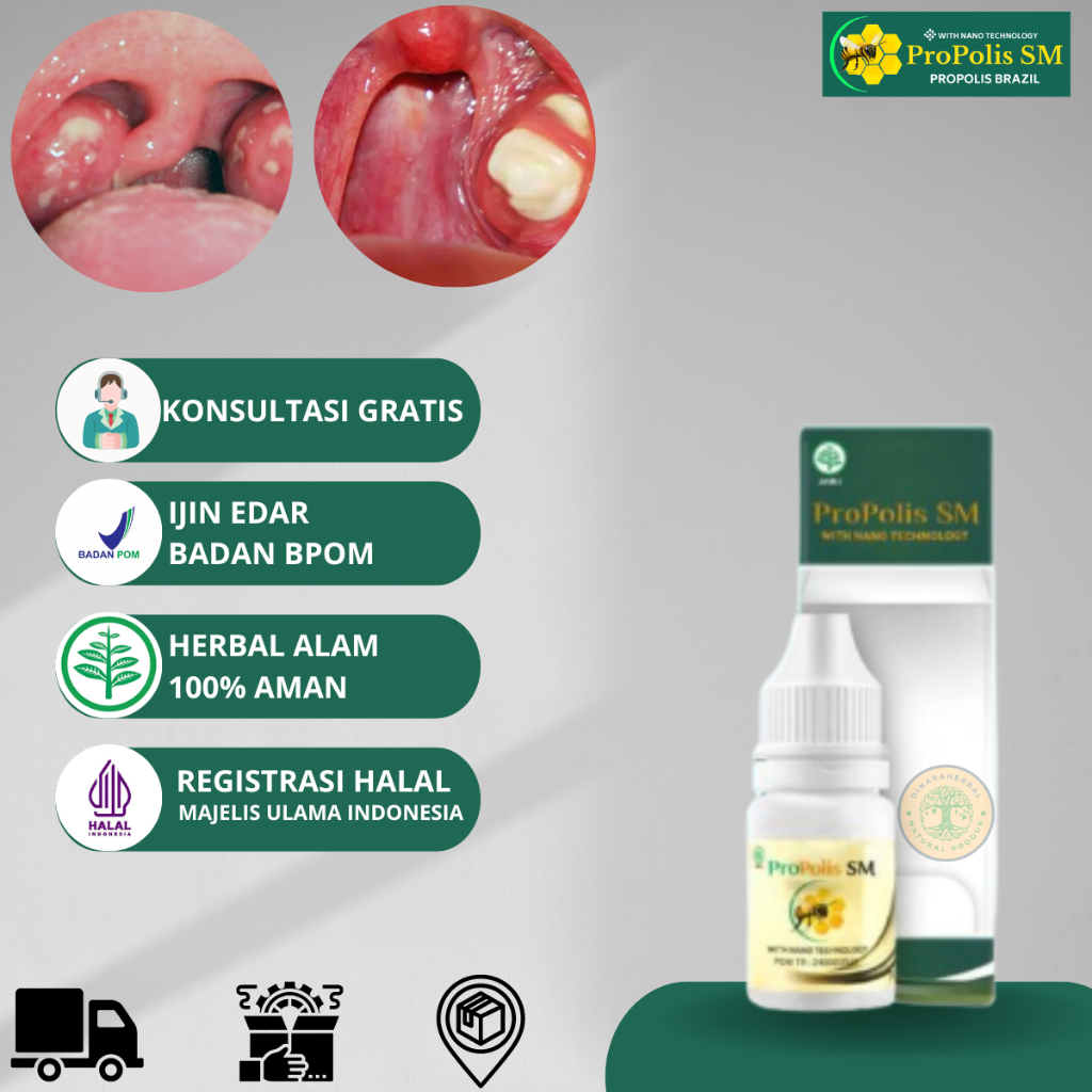 Jual Obat Amandel Akut /Pengempes Amandel / Amandel Bengkak Sebelah Tonsil Akut Dan Kronis ...