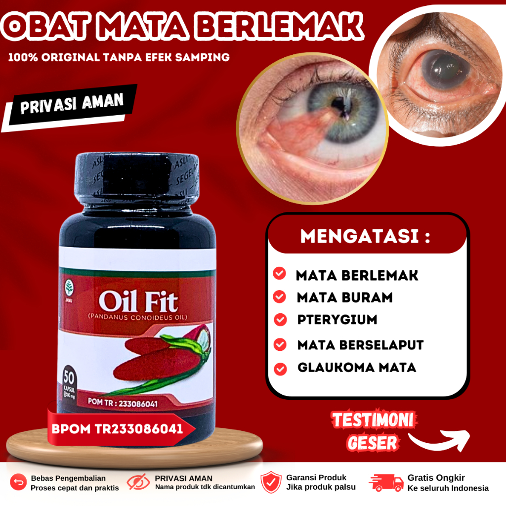 Jual Oil Fit - Obat Mata Berlemak, Obat Pterygium, Obat Mata berselaput ...