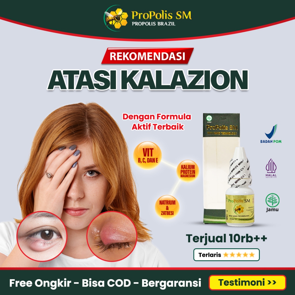 Jual Obat Kalazion Mata Bengkak Sakit Penghilang Benjolan Di Kelopak ...