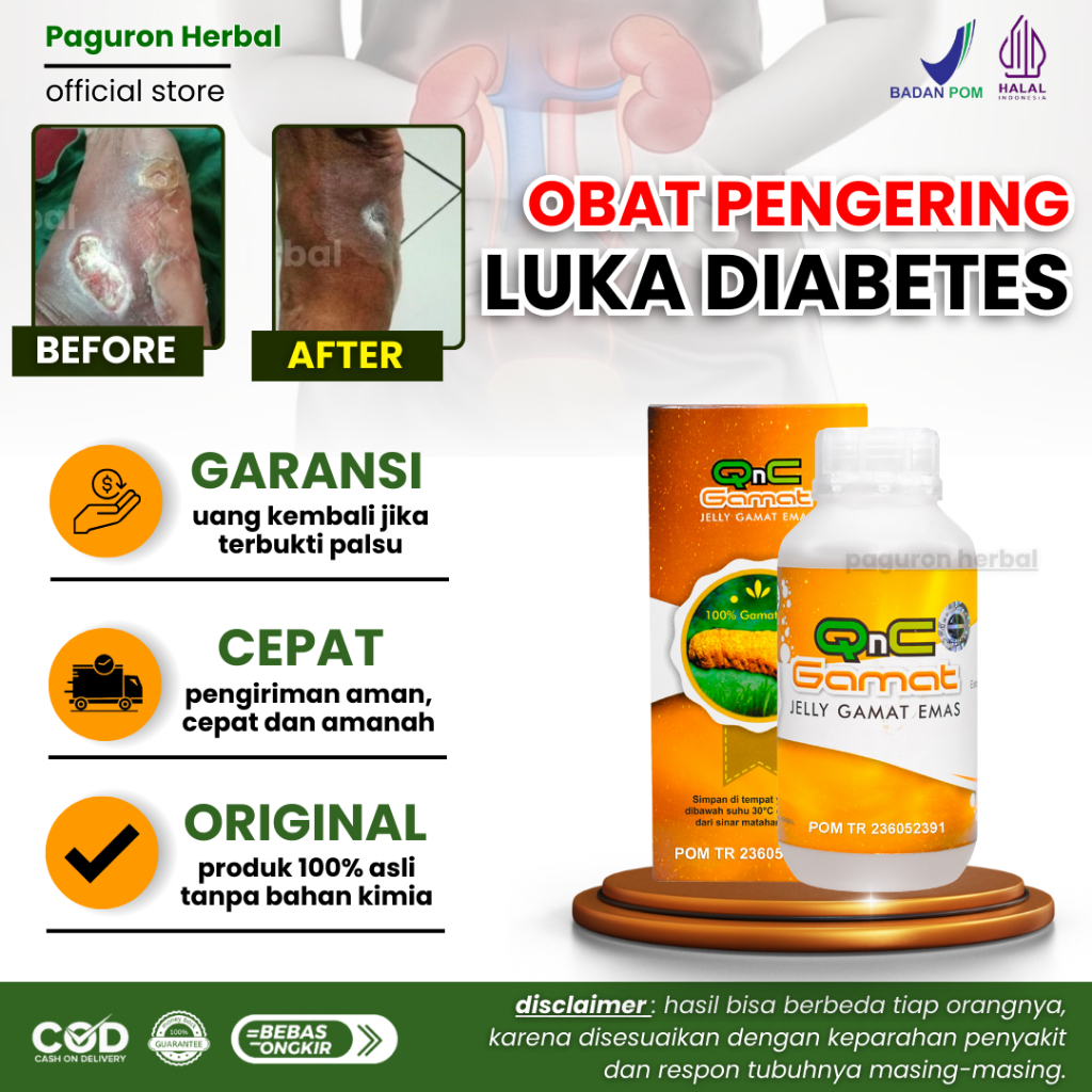 Jual OBAT PENGERING LUKA DIABETES BASAH BERNANAH CEPAT KERING DENGAN ...