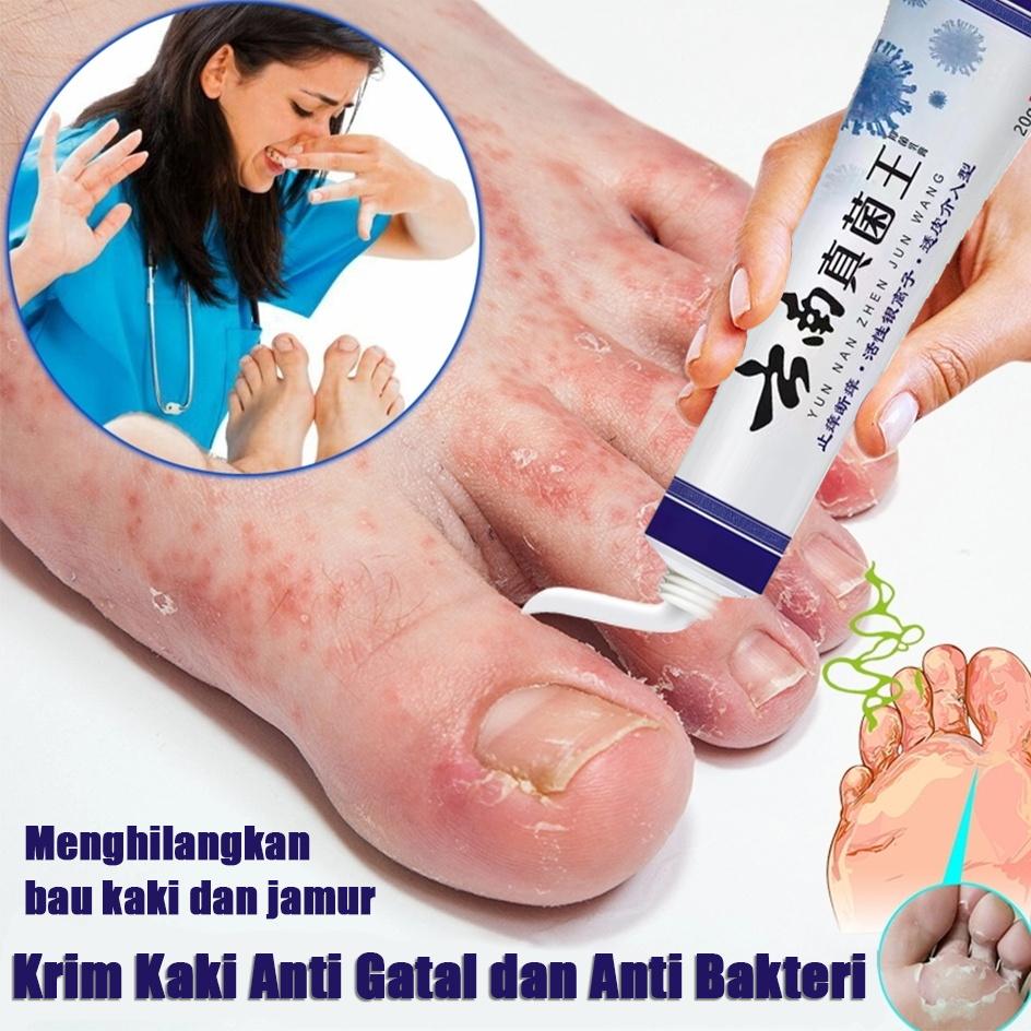 Jual Obat Kaki Rayapan Dan Bau Yunnan Baiyao Penghilang Bau Kaki Anti ...