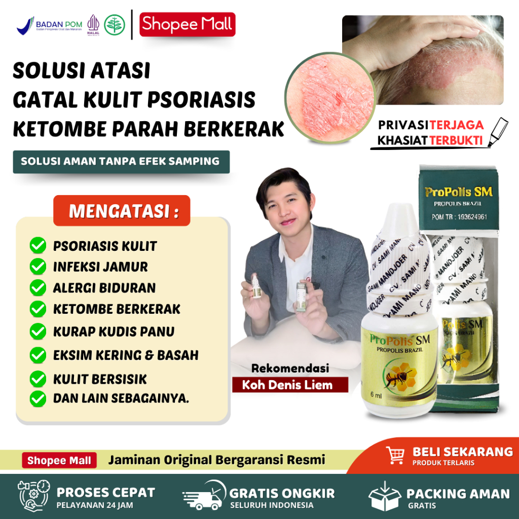Jual Obat Psoriasis Autoimun Gatal Kulit Kepala Koreng Ketombe Parah Berkerak Eksim Herpes ...