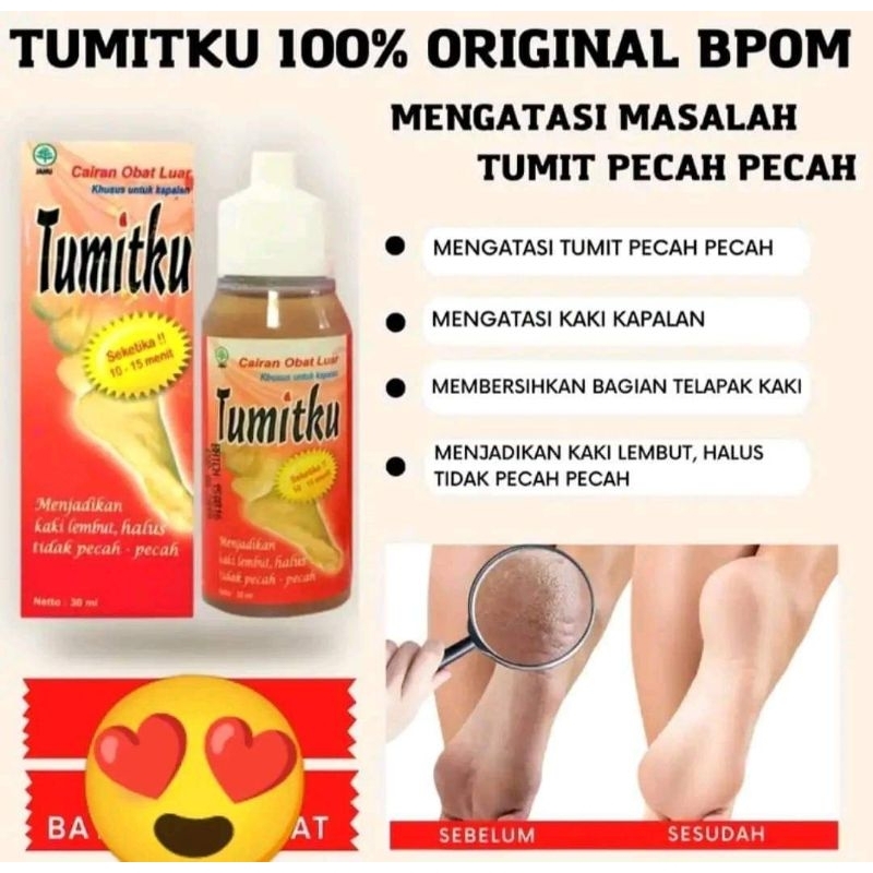 Jual TUMITKU ORIGINAL | Shopee Indonesia
