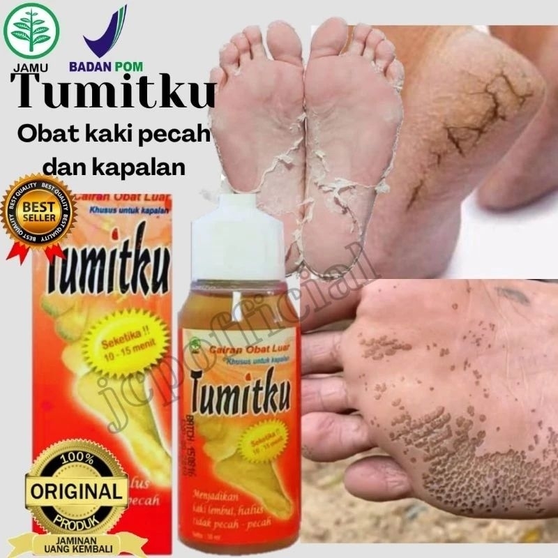 Jual TUMITKU OBAT KAKI PECAH / KAPALAN TUMITKU ORIGINAL 100% | Shopee ...