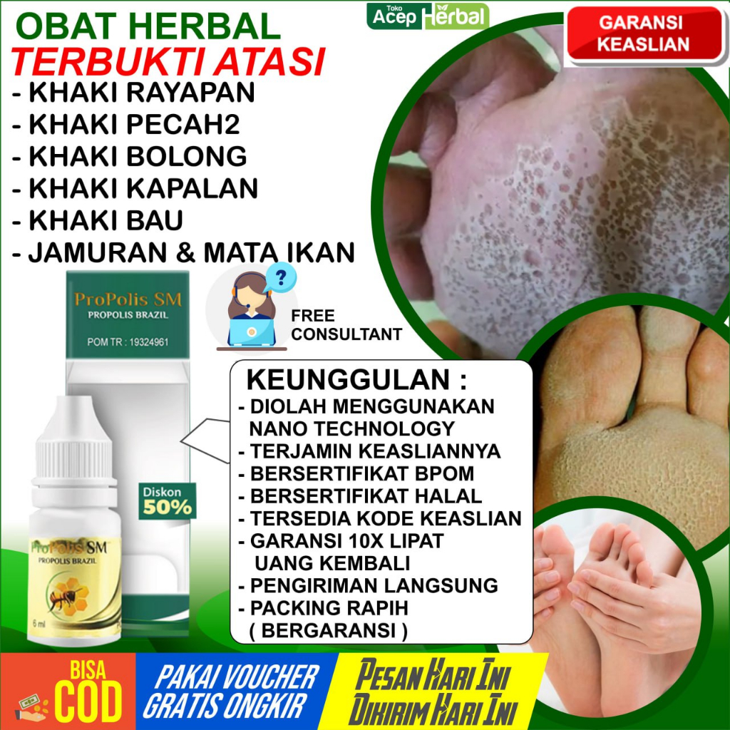 Jual Obat Kaki Rayapan Obat Penghilang Rayapan Obat Kaki Berlubang Obat ...