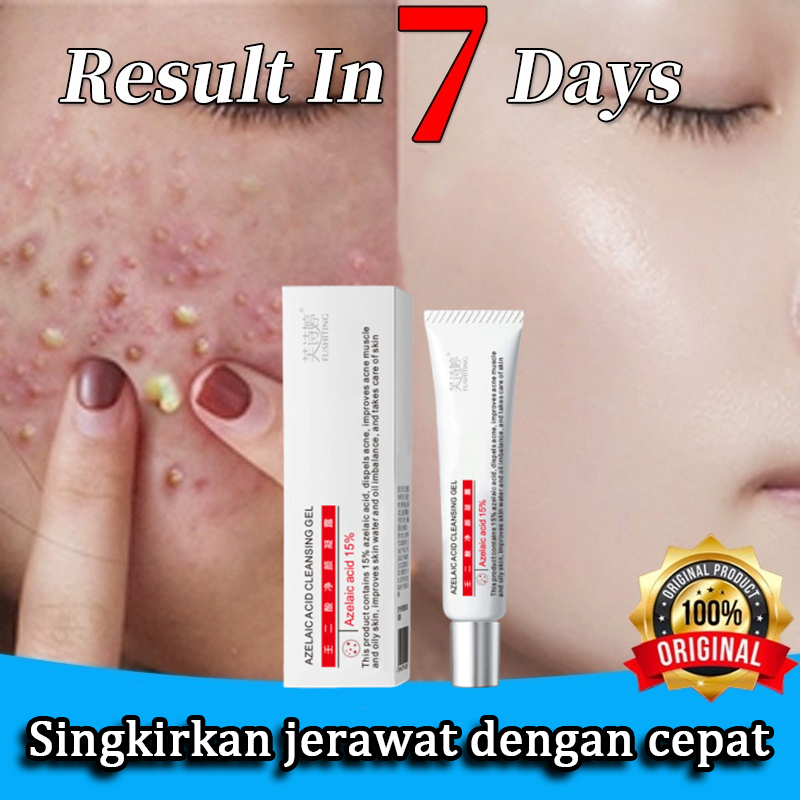 Jual Obat jerawat dan bekas jerawat penghilang bekas jerawat salep jerawat 20g obat jerawat ...