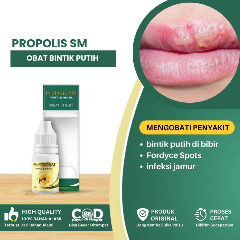 Jual Obat Untuk Bintik Putih Bibir Bagian Atas, Fordyce Spots, Bercak ...