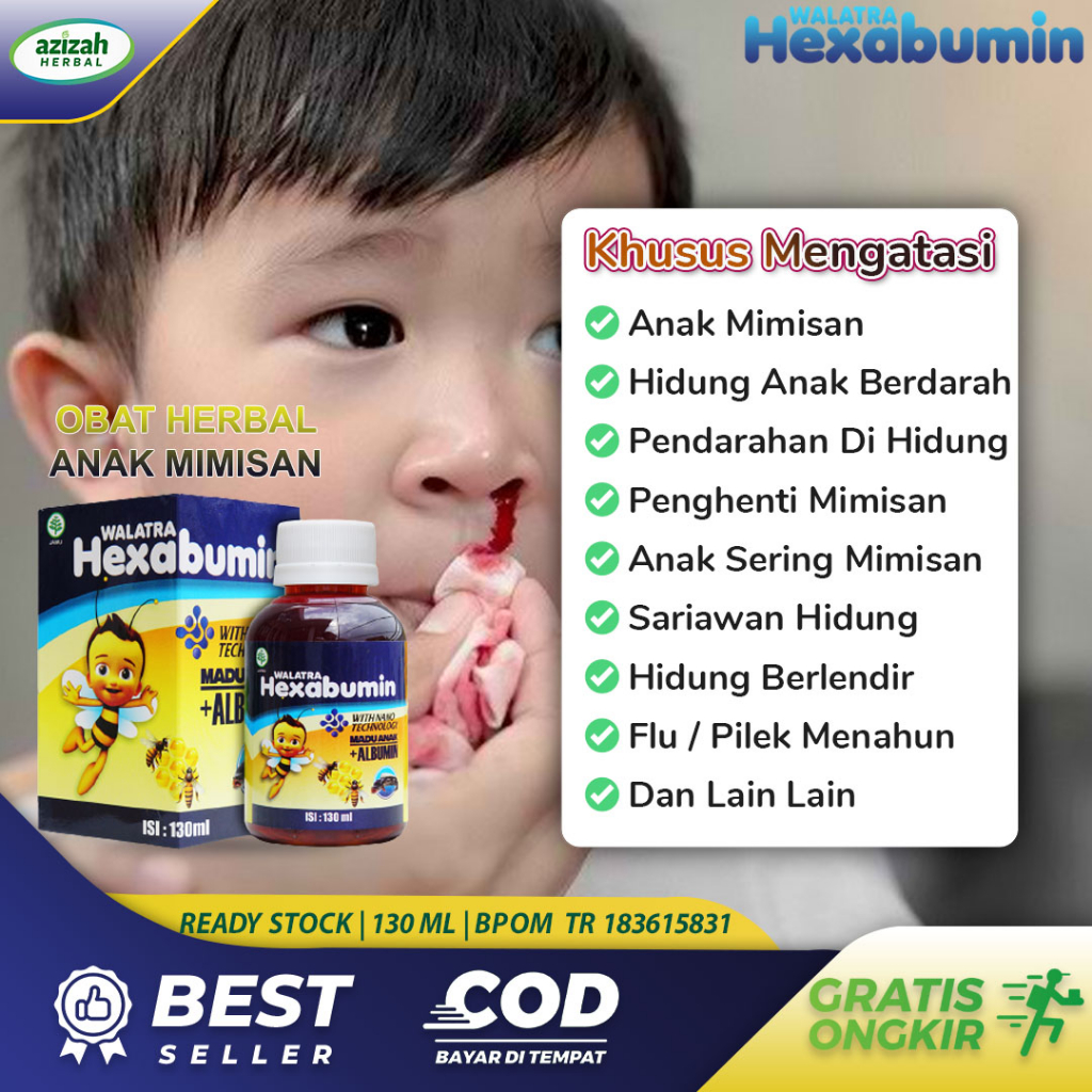Jual Obat Anak Sering Mimisan Hidung Keluar Darah Pendarahan Pada ...