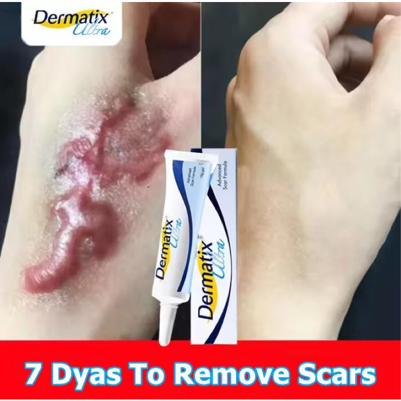 Jual Dermatix Penghilang Bekas Luka Koreng Advanced Scar Gel Dermatik ...