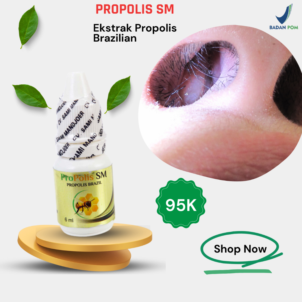 Jual Obat Sinusitis Polip Hidung Obat Rhinitis Polip Sinusitis Kronis ...