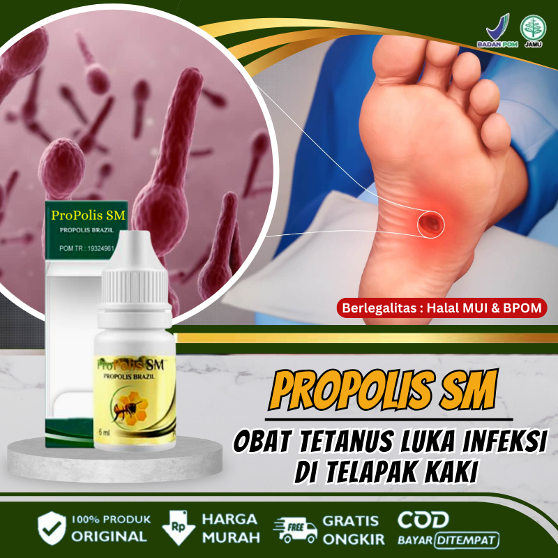 Jual Obat Luka Tetanus, Pembunuh Bakteri Infeksi Tetanus di Telapak ...