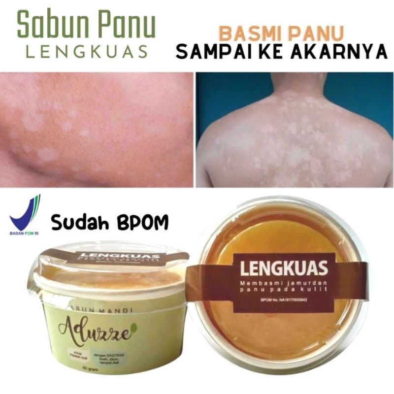 Jual (COD) Sabun Herbal Lengkuas untuk Panu Kadas Kurap BPOM | Shopee ...