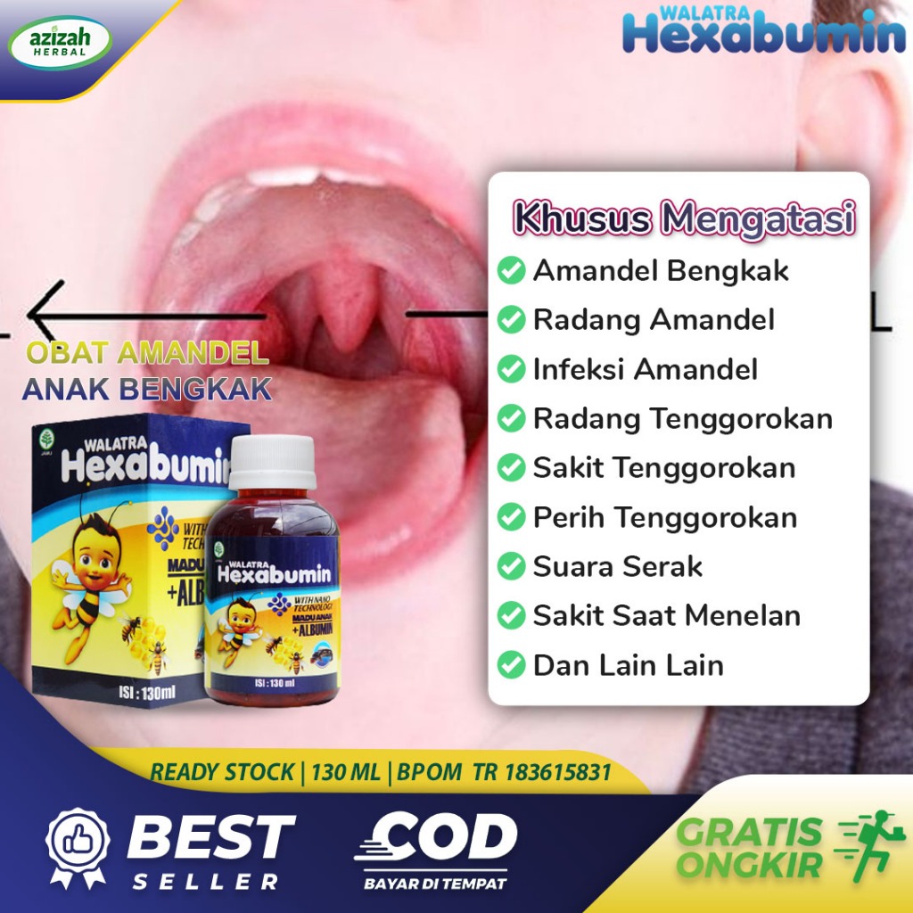 Jual Obat Amandel Anak Bengkak Infeksi Amandel Tonsilitis Radang Tenggorokan Suara Serak Sakit ...