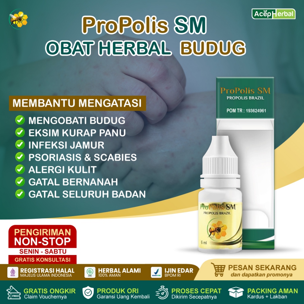 Jual Propolis Sm Obat Herbal Budug Gudig Salep Kutu Air Infeksi Jamur ...