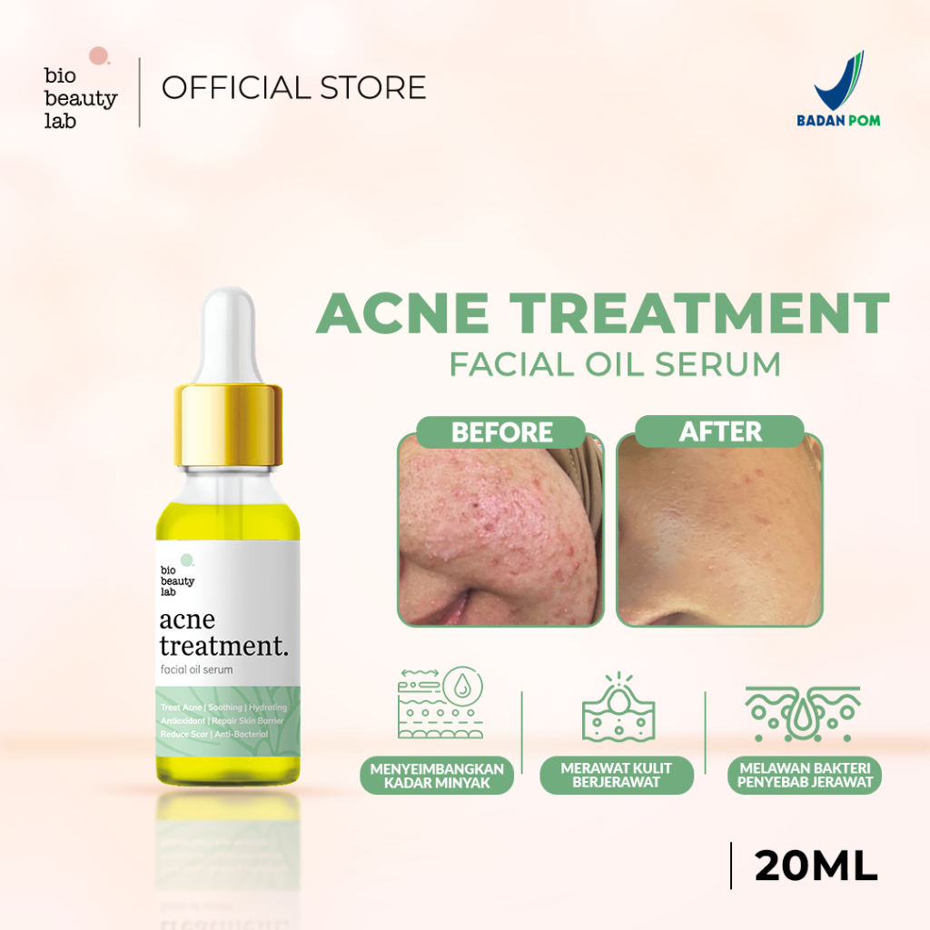 Jual BIO BEAUTY LAB Acne Treatment (HEALING) Facial Oil Serum 5ml ...