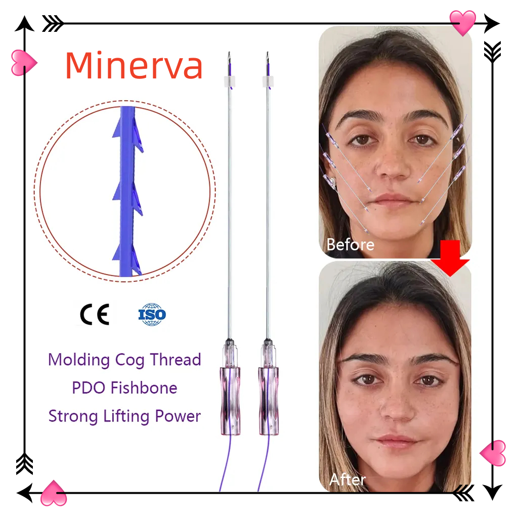 Jual U8S1 Minerva Face thread lift PDO / PCL Eceran | Shopee Indonesia