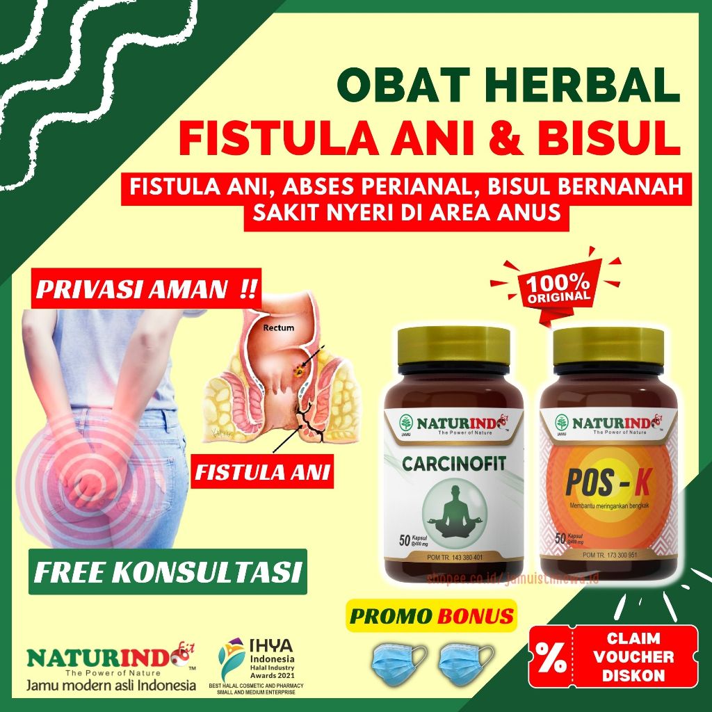Jual Obat Fistula Ani Bisul di Pantat Bisul Bernanah Herbal Ampuh Abses ...
