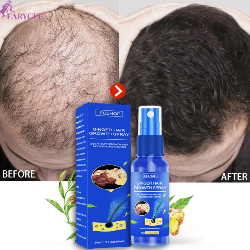 Jual EARYCEE Hair Growth Spray Semprotan Penumbuh Rambut Hair Growth ...