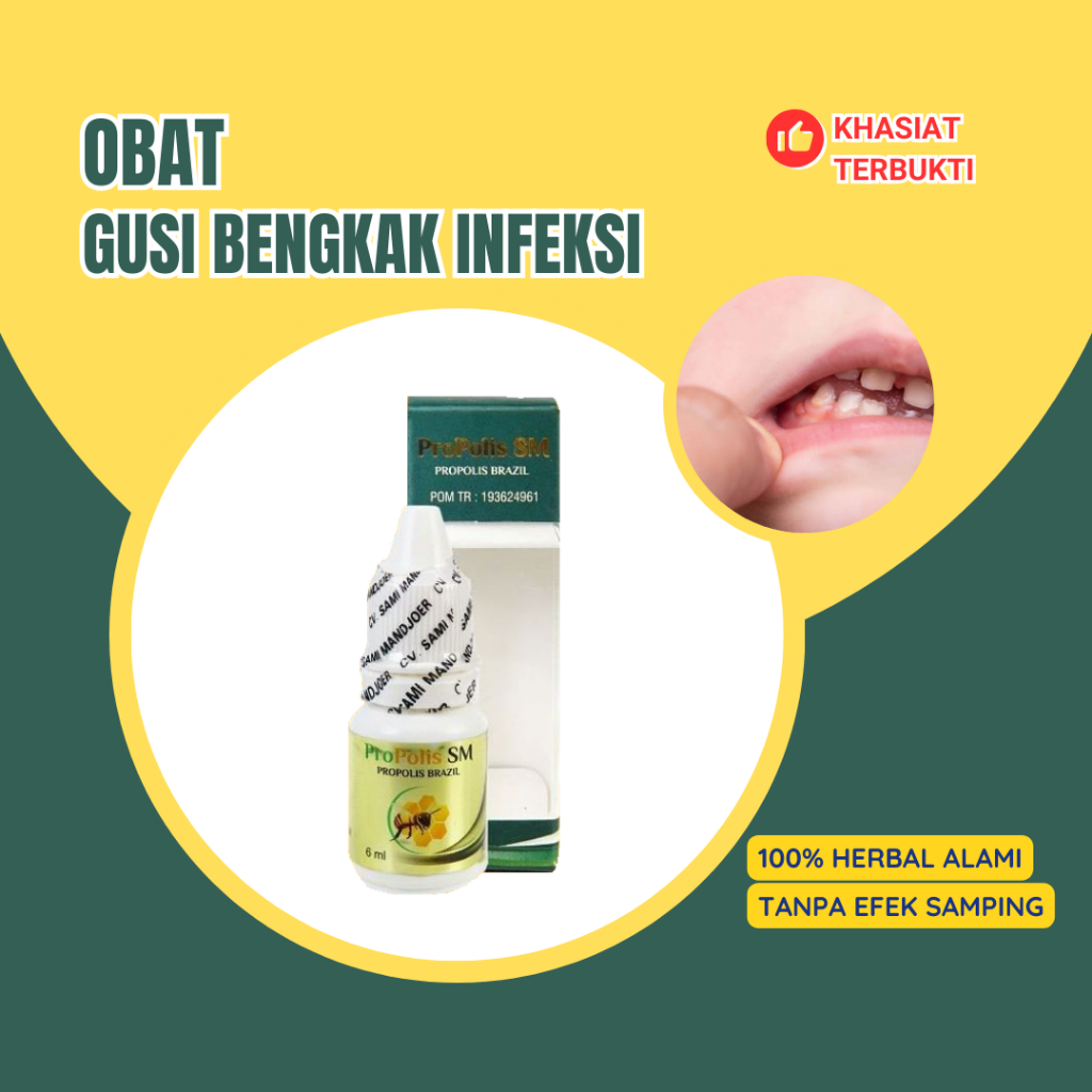 Jual Obat Gusi Bengkak Bernanah Gigi Berlubang, Radang Gusi Berdarah ...