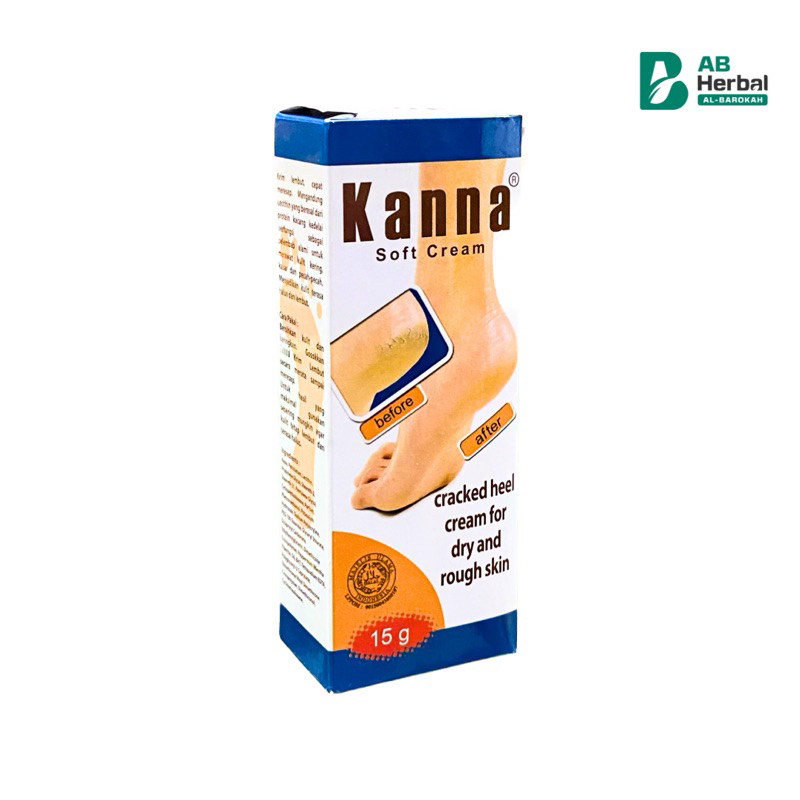 Jual KANNA SOFT CREAM / KANNA KRIM LEMBUT 15GR/30gr KULIT KERING KASAR ...