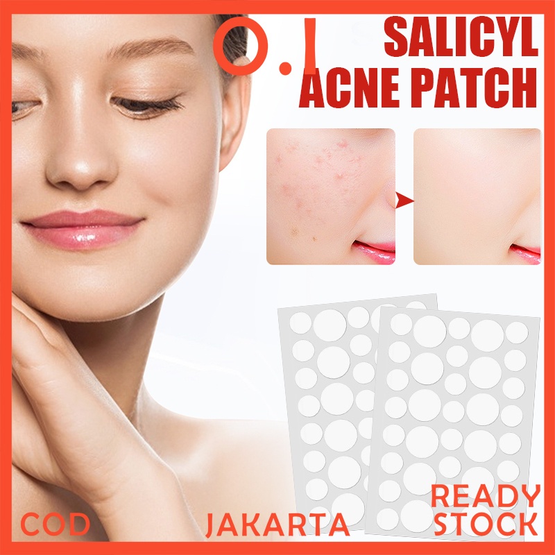 Jual 36Pcs Stiker Jerawat Transparan Invisible Acne Pimple Patch ...