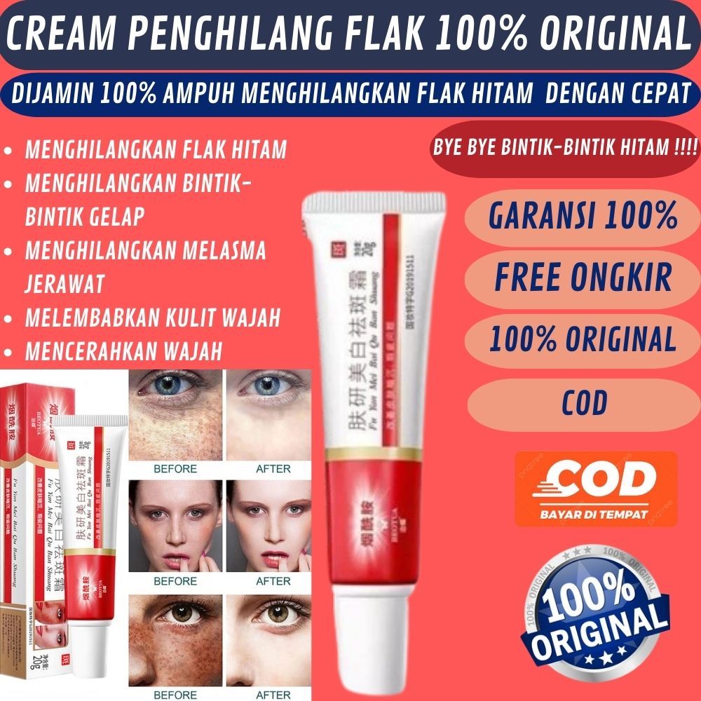 Jual Cream Crem Crim Salep Penghilang Flak Hitam / Krim Pemutih ...