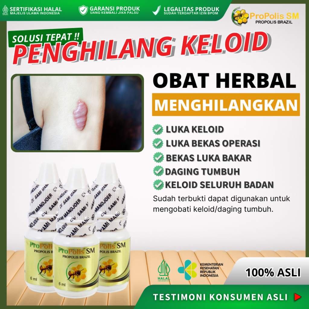 Jual Obat Keloid / Daging Tumbuh / Daging Jadi, Penghilang Keloid Bekas Operasi, Keloid Luka ...