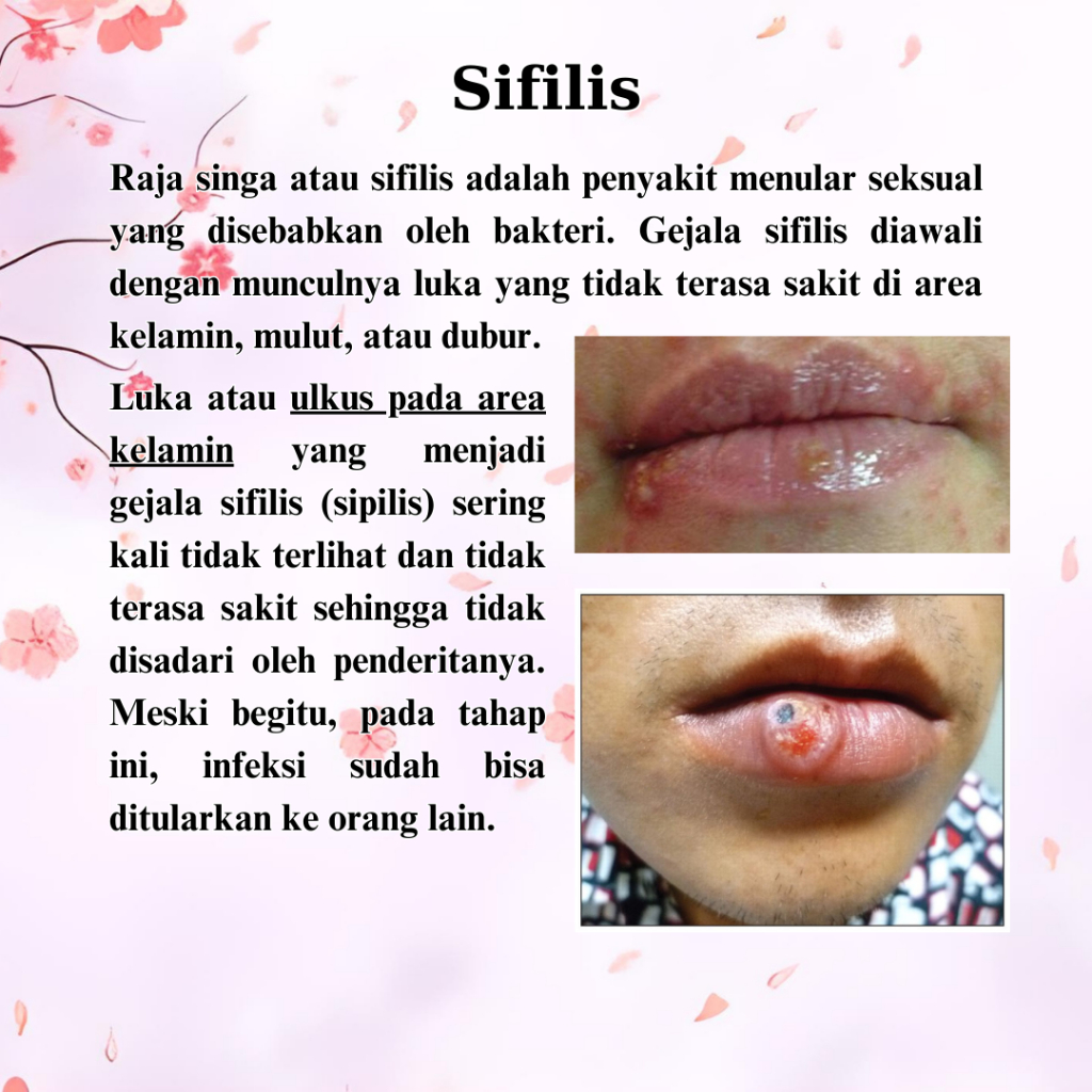 Jual Obat Sifilis Raja Singa Sipilis Penyakit menular Seksual Herbal ...