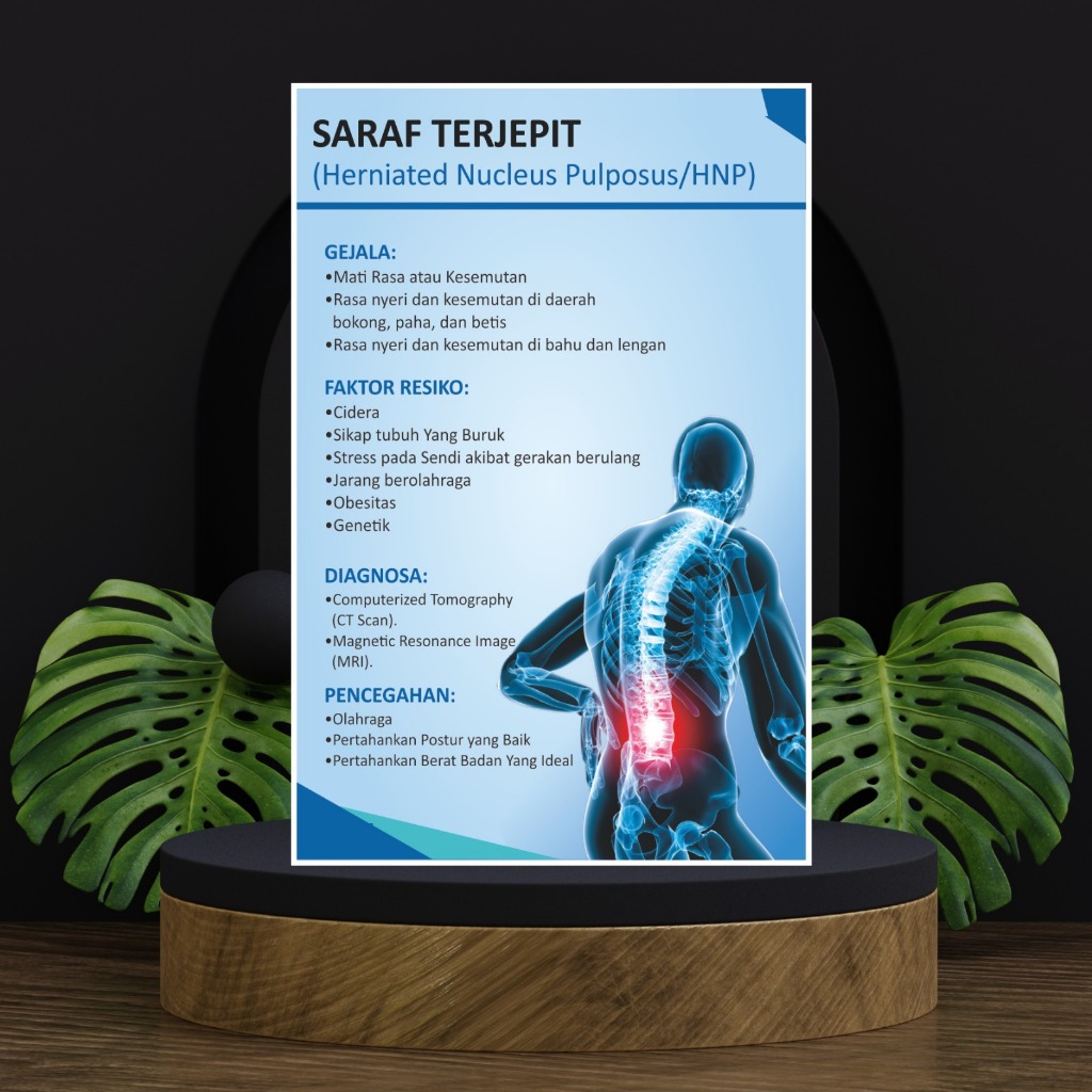 Jual Poster Kesehatan Saraf Terjepit | Shopee Indonesia