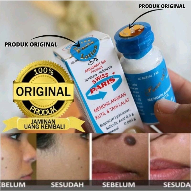 Jual Swiss Paris Lotion Obat Salep Penghilang Kutil dan Tai Lalat ...