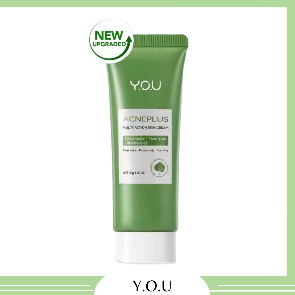 Jual You Acne Plus Multi Action Skin Cream 30g / Pelembab Wajah ...