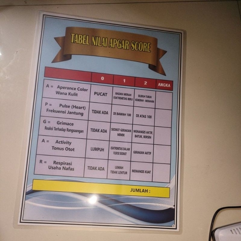 Jual Poster Tabel Nilai Apgar Score New 2022 | Shopee Indonesia