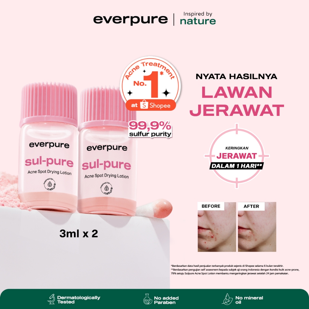 Jual [TWINPACK] Everpure Sul-Pure Acne Spot Drying Lotion 3ml - Obat ...