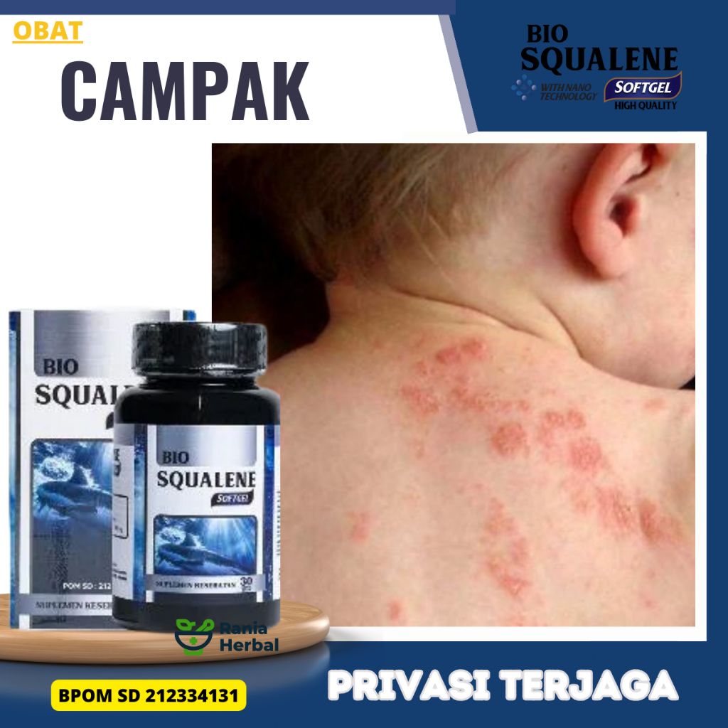 Jual Obat Campak, Obat Infeksi Jamur Kulit, Obat Bintik Merah Gatal ...