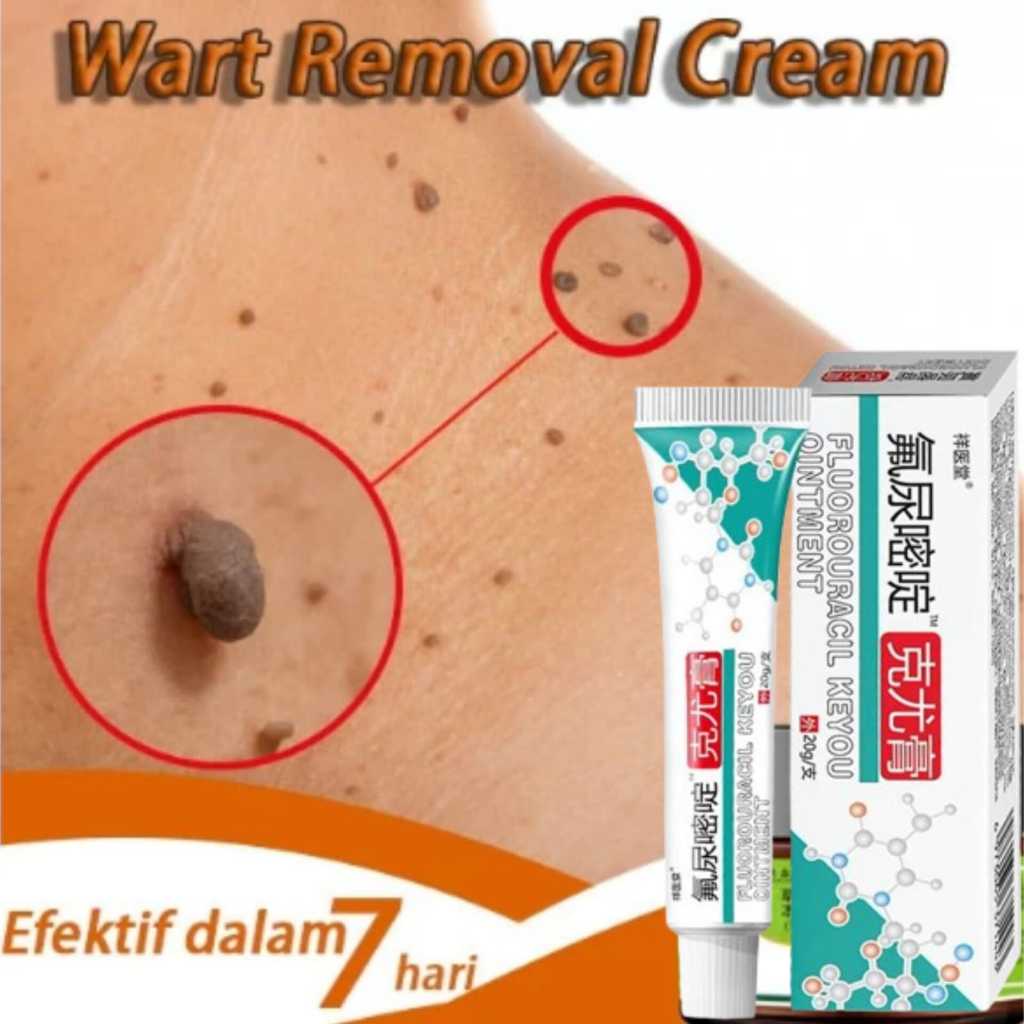 Jual KEYOU OINMENT Penghilang Kutil dan Tahi Lalat Obat Penghilang ...