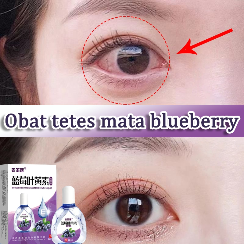 Jual [READY STOCK] Obat mata eyebost obat mata obat tetes mata katarak ...