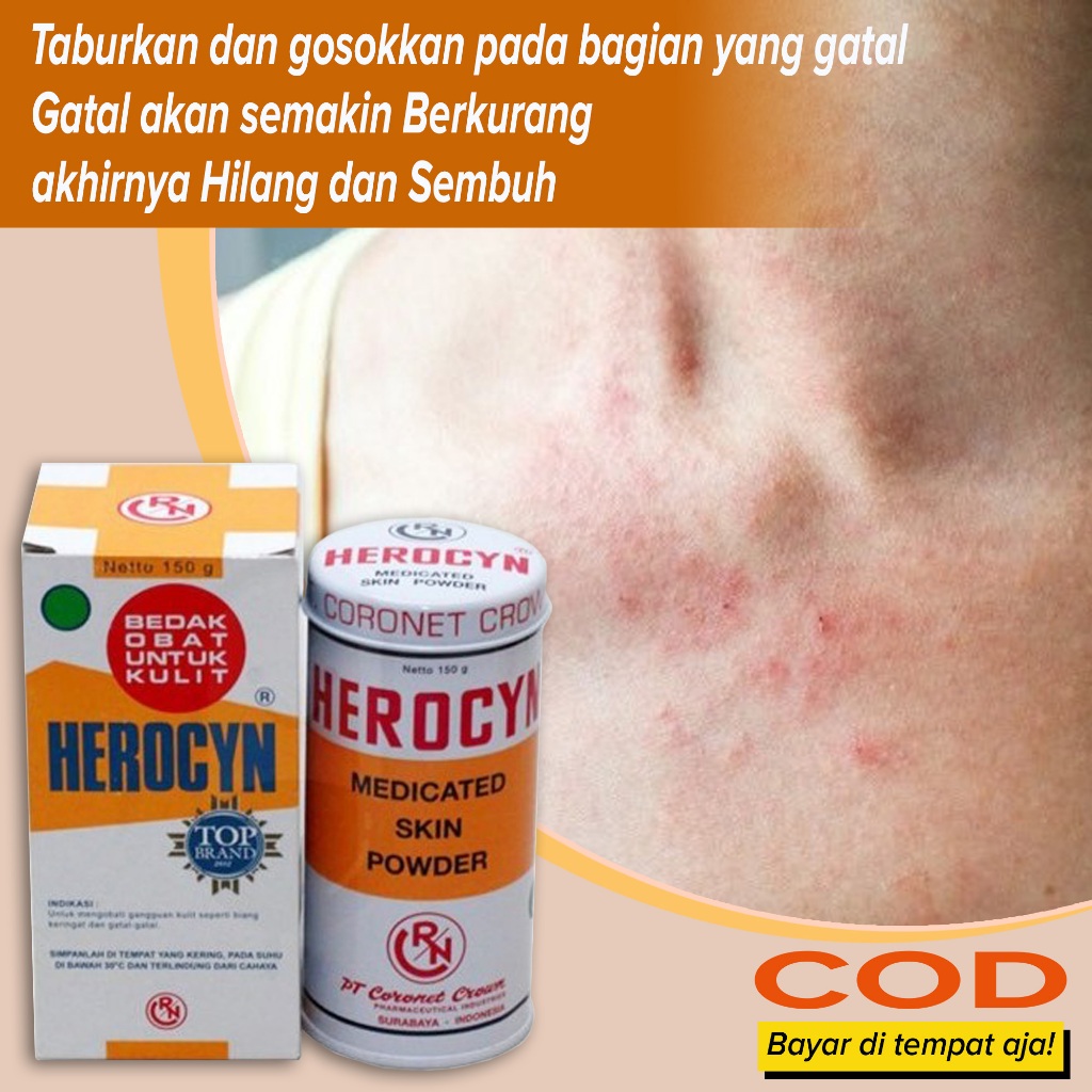 Jual Bedak obat gatal Kulit AMPUH Mengobati gatal Biyang keringat gatal ...