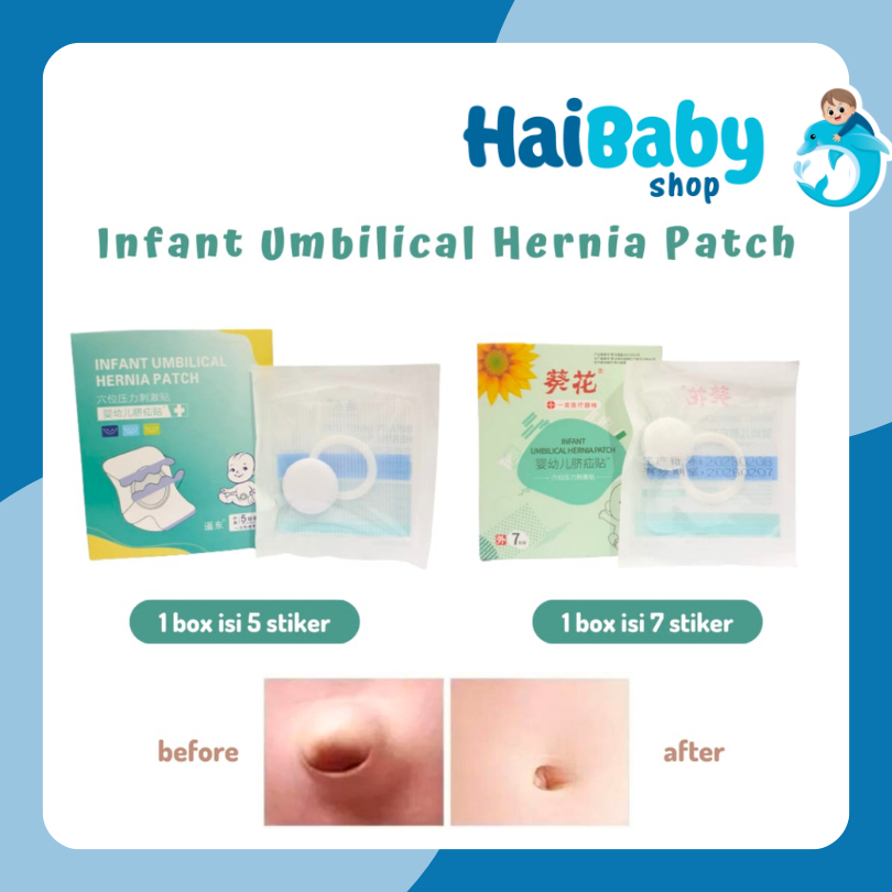 Jual Infant Umbilical Hernia Patch / Koyo anti pusar bodong 1Box isi ...