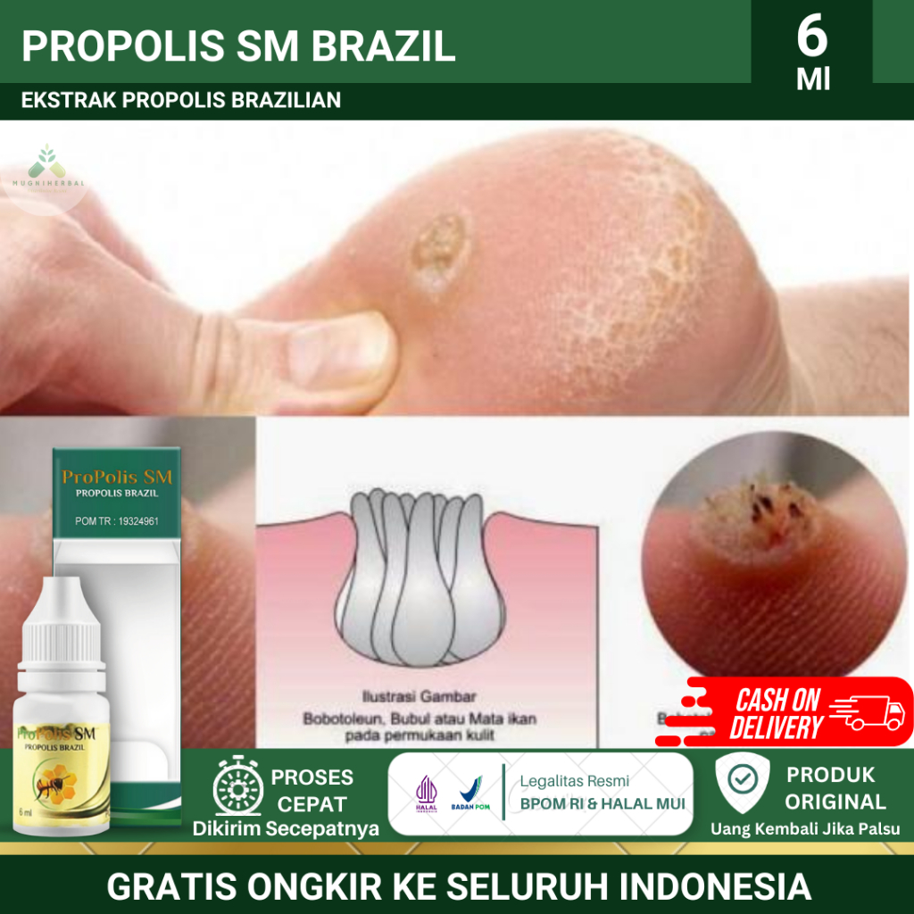 Jual Propolis SM - Obat Tetes Perontok Mata Ikan Di Telapak Kaki, Mata ...
