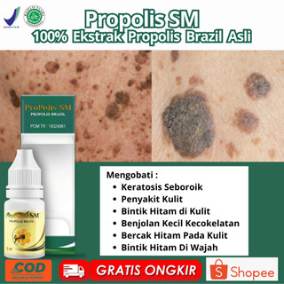 Jual Obat Keratosis Seboroik Penghilang Bintik Hitam Di Wajah Bintik ...