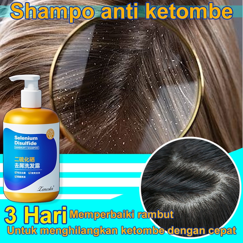 Jual Sampo shampoo anti ketombe sampo anti ketombe 300ML Sampo Anti Patah dan Rontok, Menguatkan ...